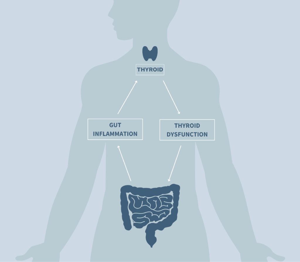 Best Thyroid Health Miami, FL | Dr. Jason Shapiro